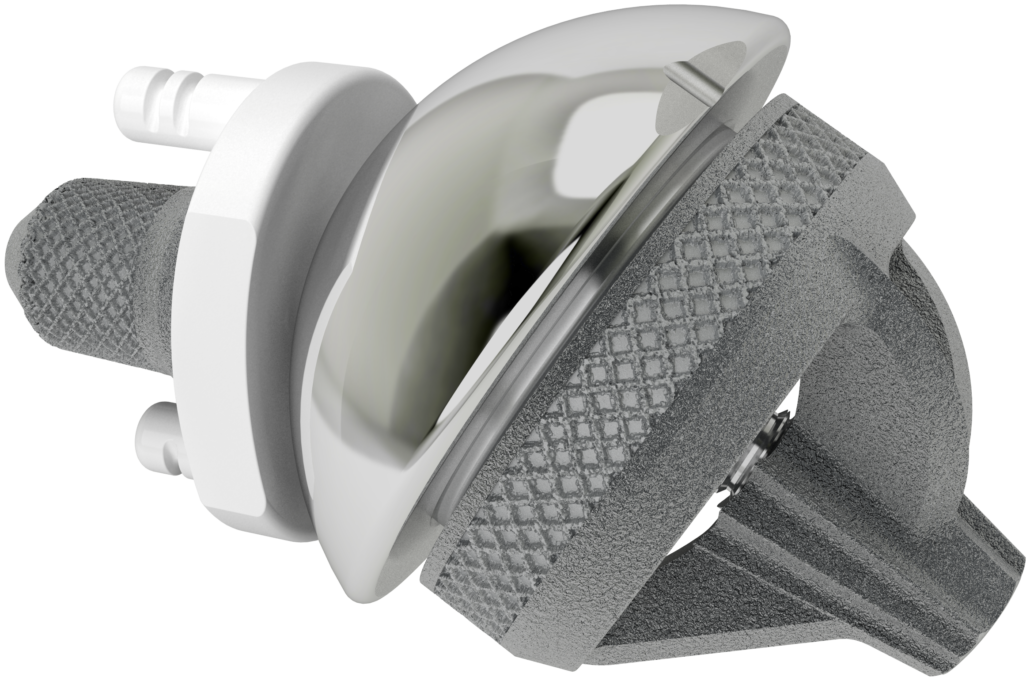 SMR Stemless - AMPOWER Report on Additive Manufacturing